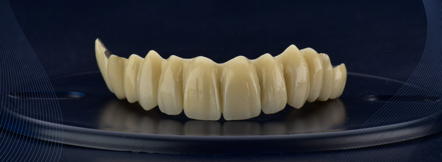 Metal Porcelana - Laboratorio Dental Luis Milanés